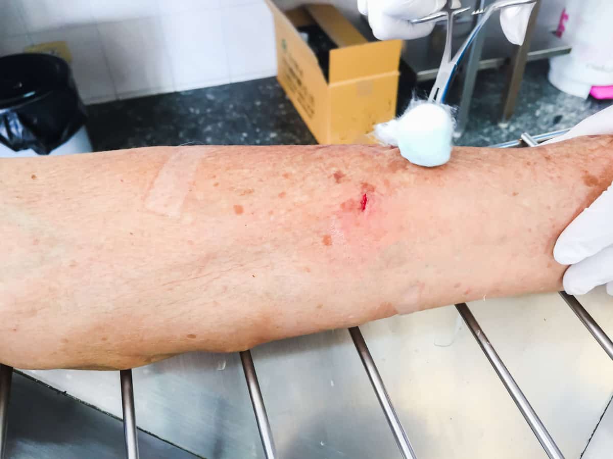 How To Clean My Dog's Dog Bite at Larry Childs blog